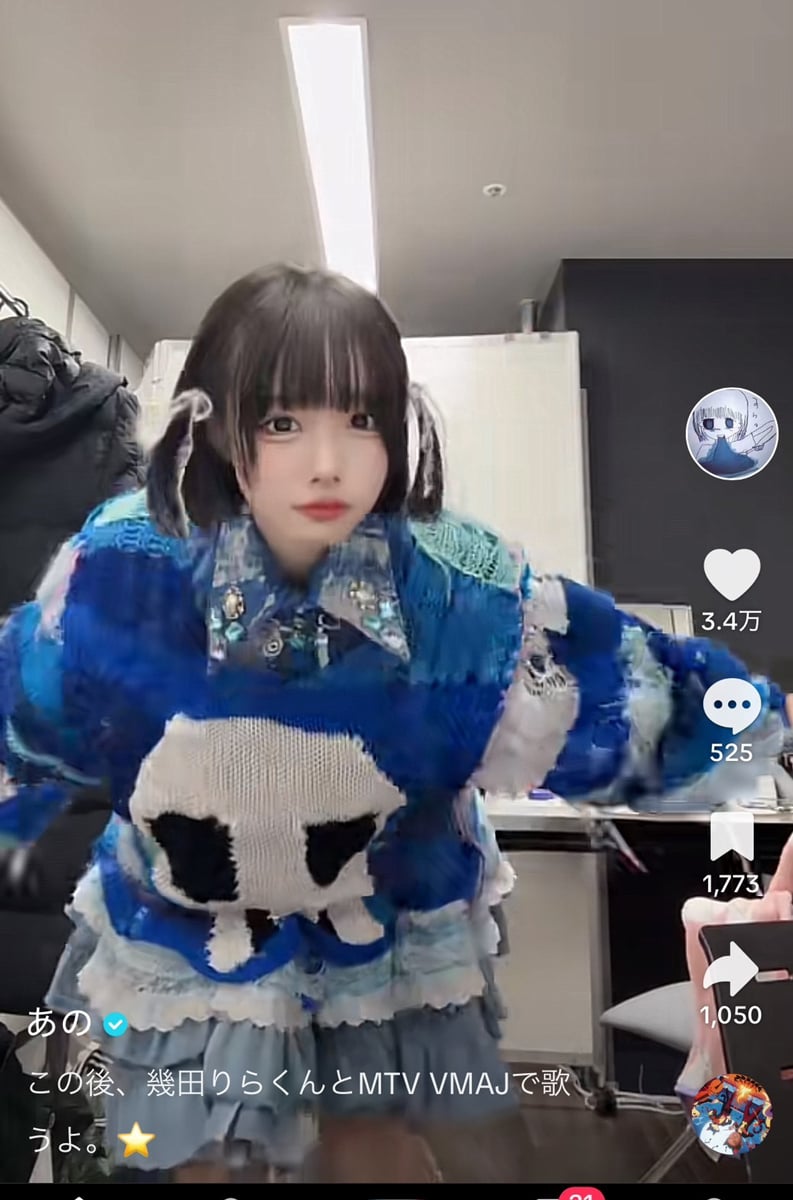 あのちゃんが「YAJU&U」にのせて「野獣先輩ダンス」を披露！？ SNSがざわつく ｜ ガジェット通信 GetNews